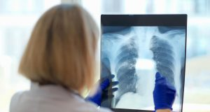 Most Doctors Believe Vaping Causes COPD But Science Shows Otherwise ...